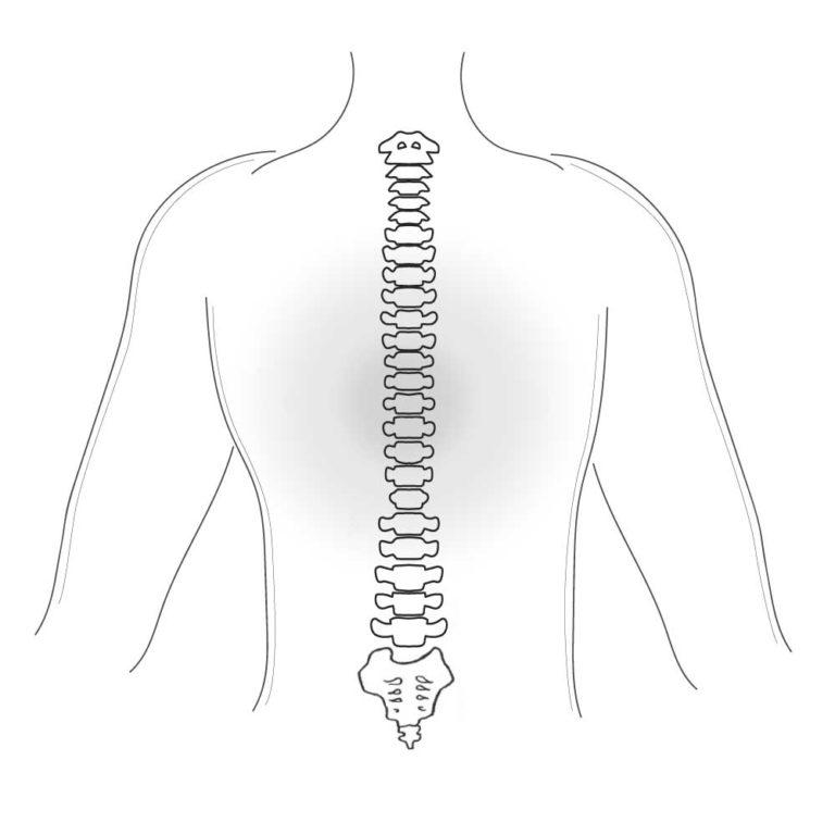 Spine - Oregon Surgical Institute